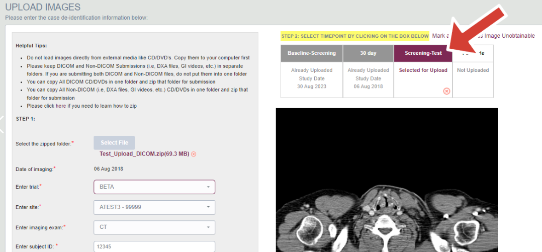 Uploading Images into Smart Submit (DICOM and non-DICOM) – SMART SUBMIT KNOWLEDGEBASE